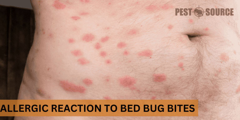 Allergic Reaction to Bed Bug Bites - Pest Source